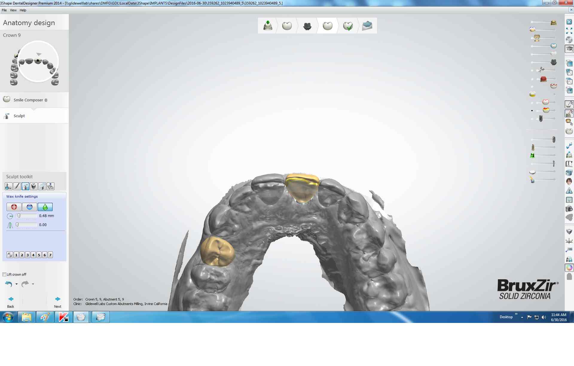 Implants of the day | Dr. Gentry